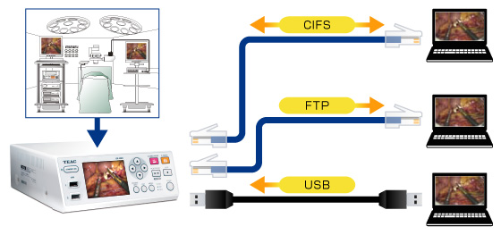 Features - High-Definition Medical Imaging Recorder UR-4MD - Medical ...